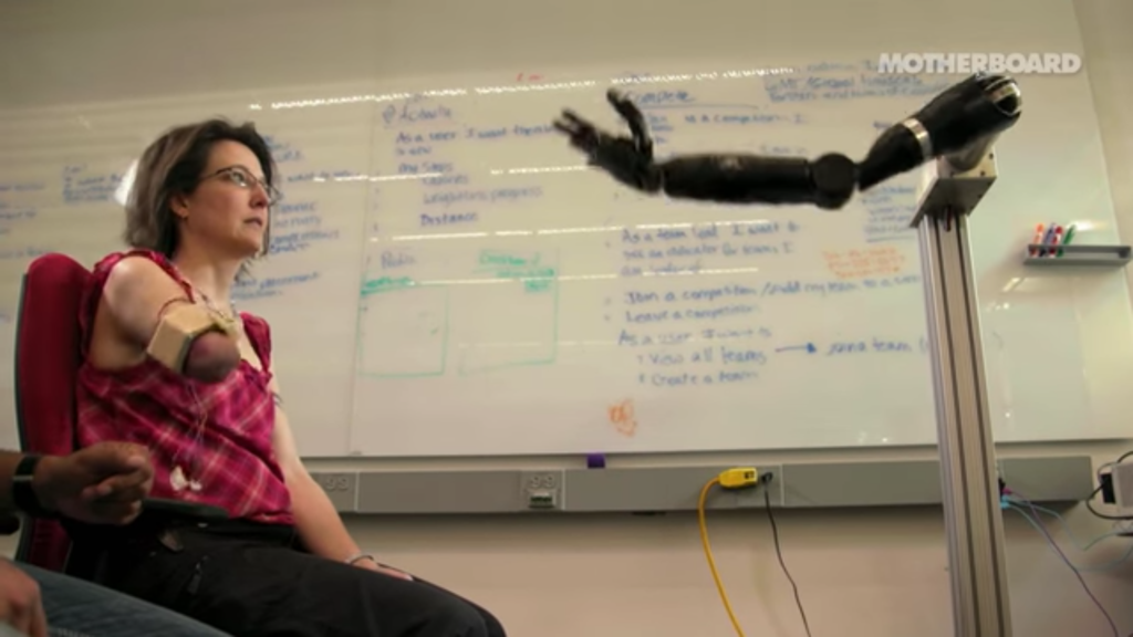 This Mind-Controlled Bionic Arm Can Touch and Feel. – Roberts Health Foods